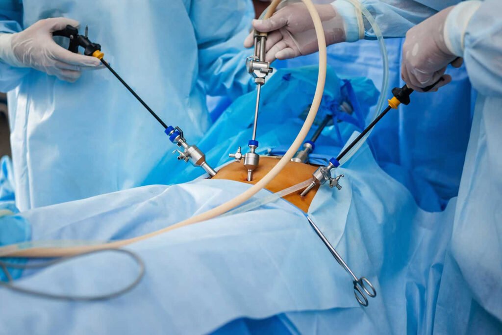 Bhagwan Das Hospital Sonipat | Laparoscopic Surgery